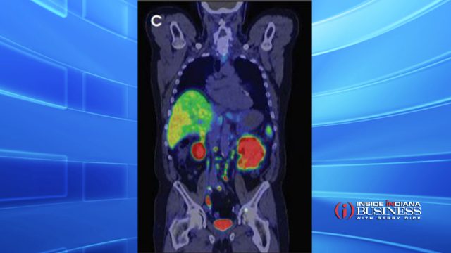 Telix FDA Approval Strengthens Radiopharma in Indy – Inside INdiana ...