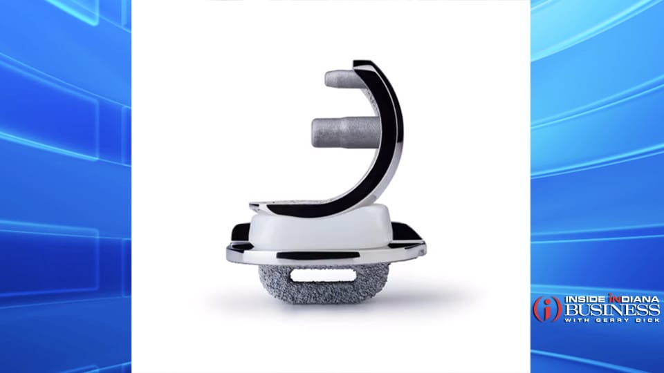 Zimmer Biomet ‘cementless’ partial knee implant makes Indiana debut ...